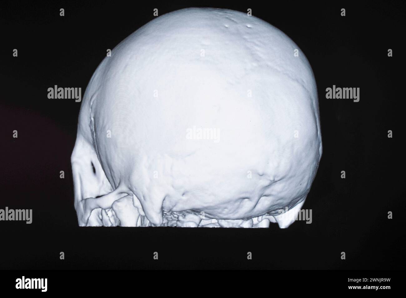 Human skull CT scans Stock Photo - Alamy