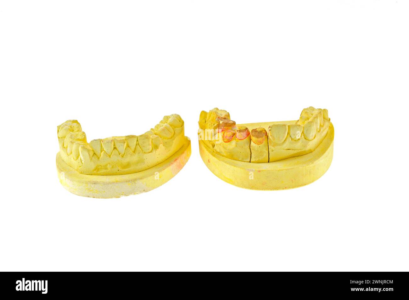 The tooth mold Stock Photo - Alamy