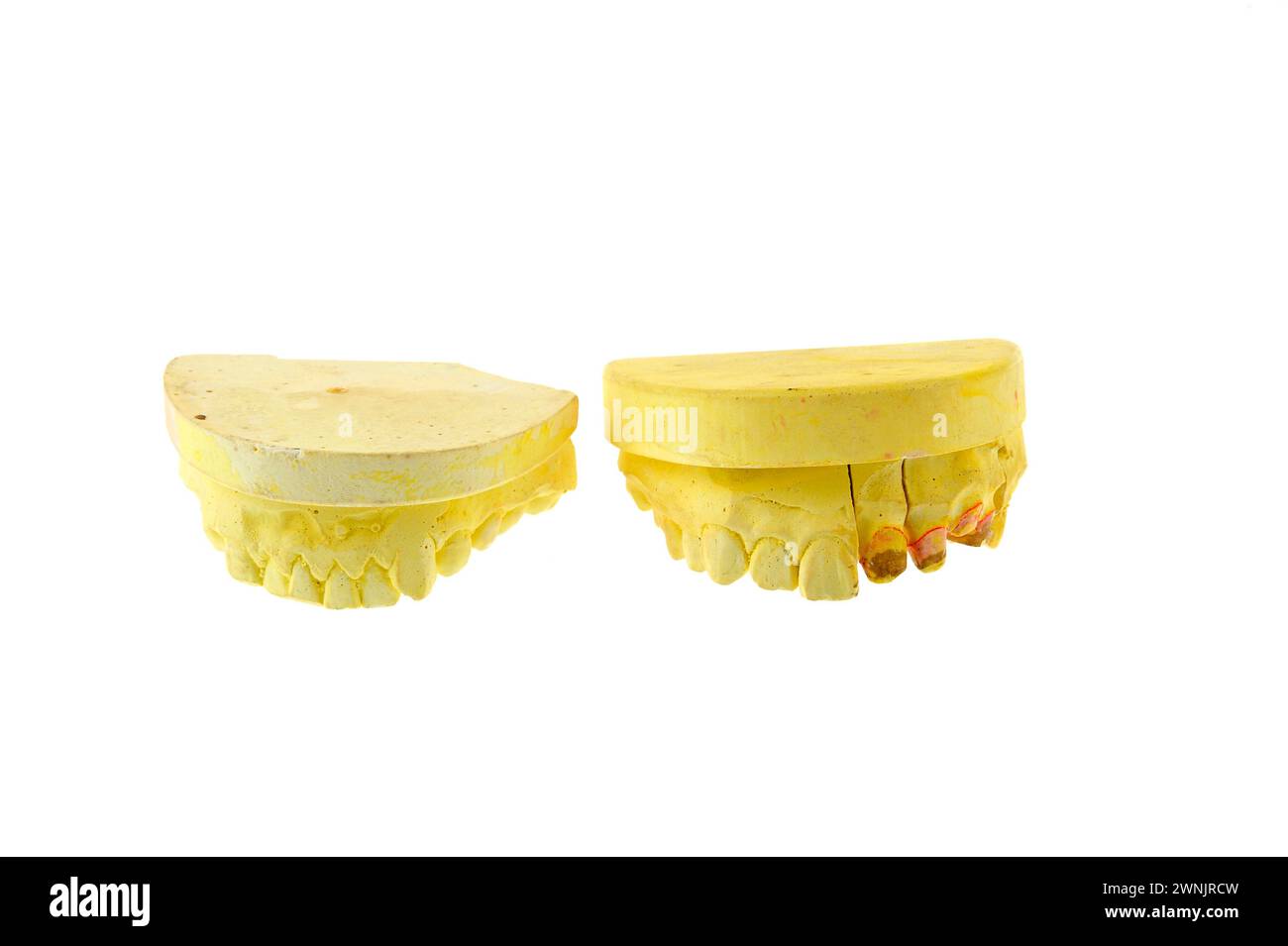 The tooth mold Stock Photo - Alamy