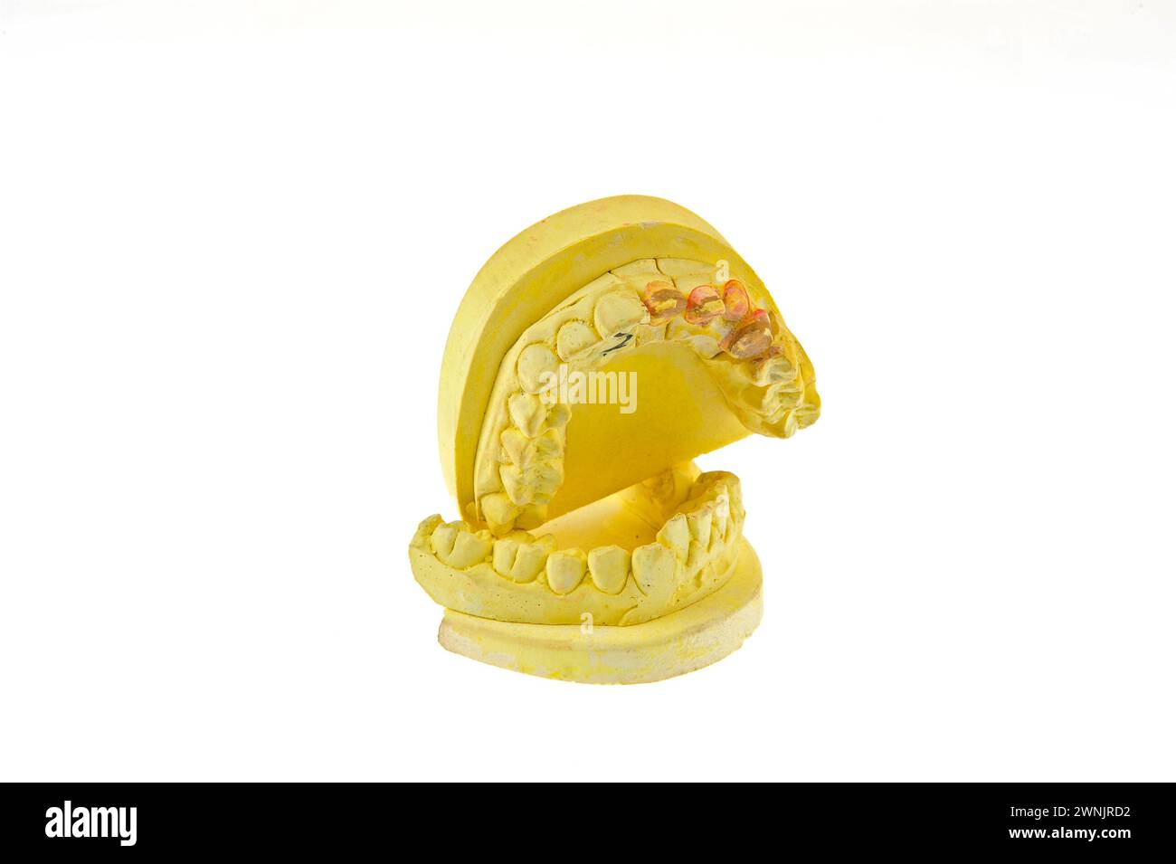 The tooth mold Stock Photo - Alamy