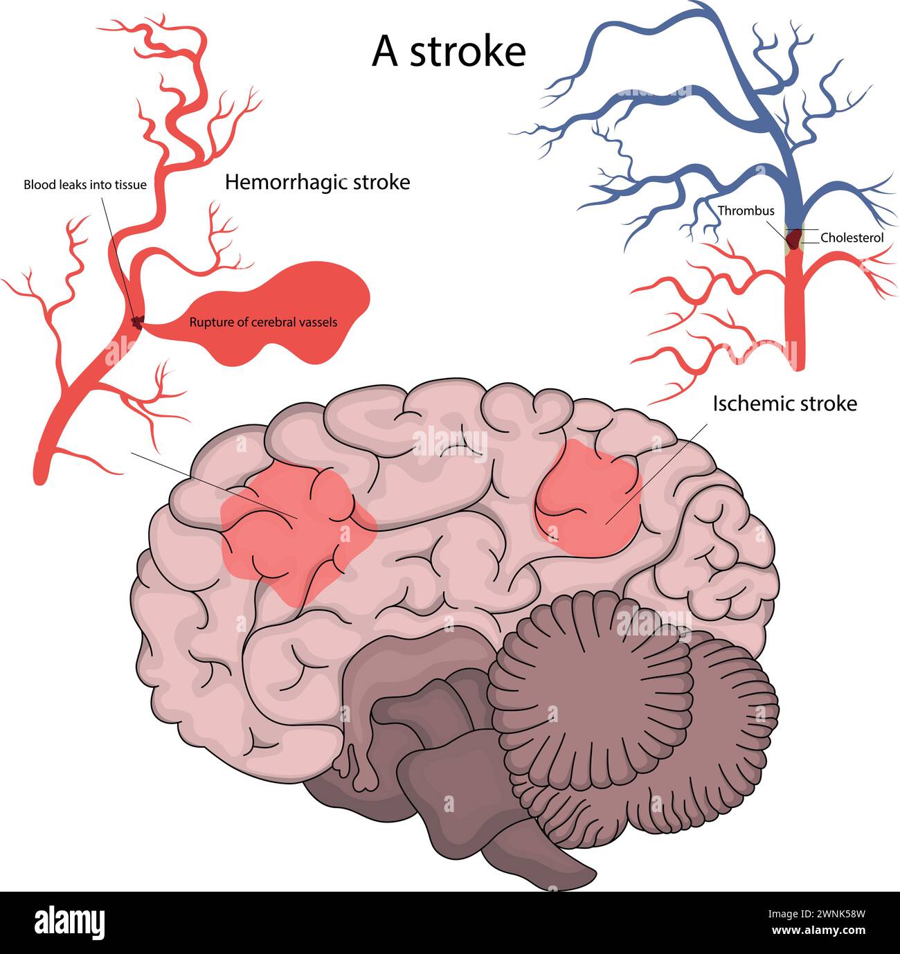 Human body brain pain illustration Stock Vector Images - Alamy