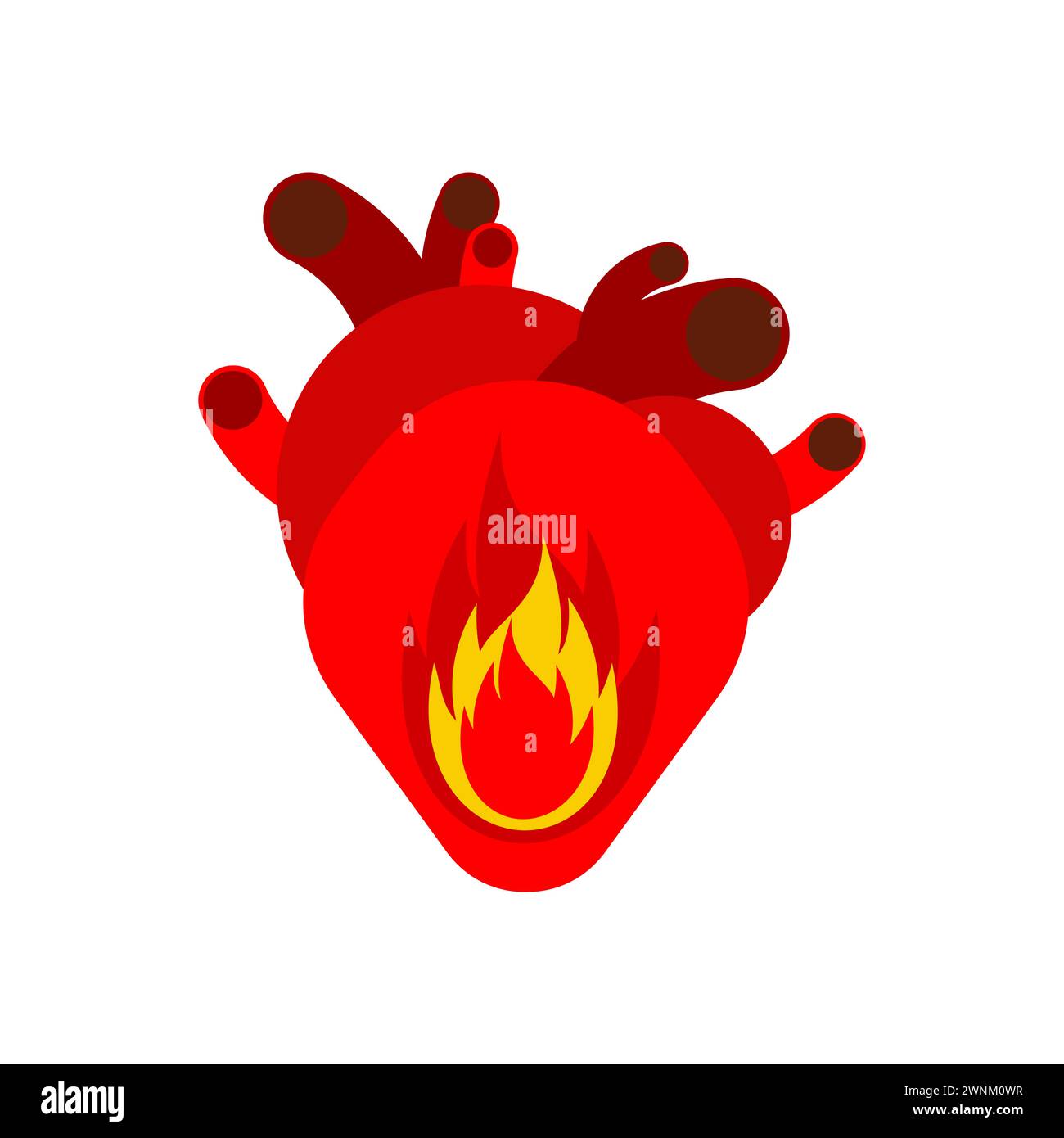 Fire in heart. Flame in an anatomical heart. Concept burning heart ...