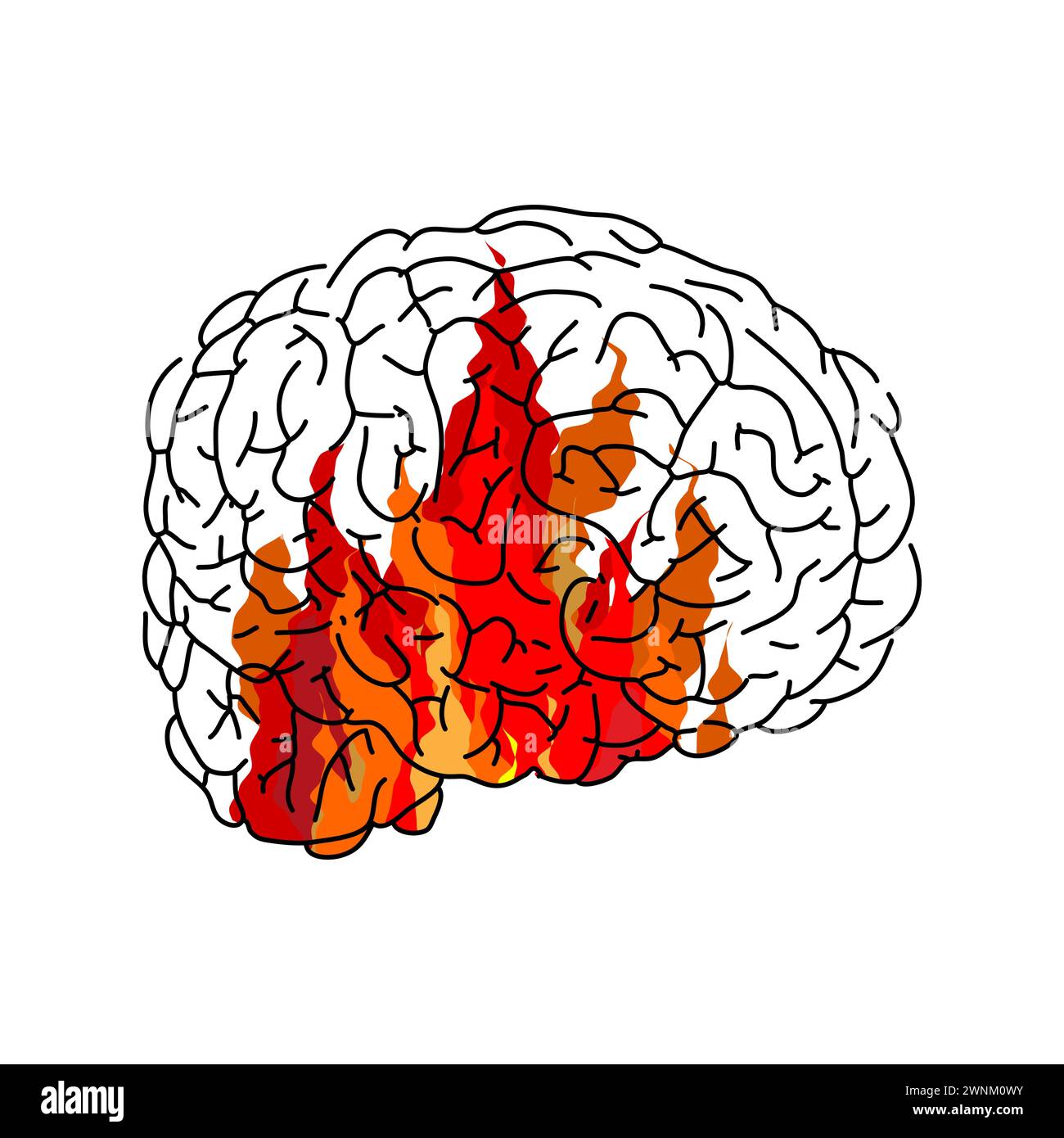 Fire in brain. Flame in an anatomical brains. Concept burning brain ...