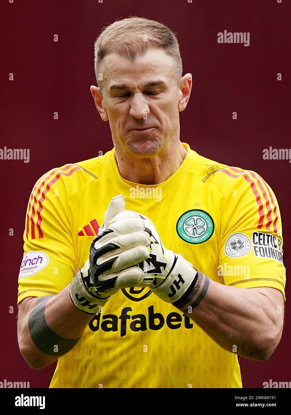 Celtic goalkeeper Joe Hart reacts following the cinch Premiership match ...