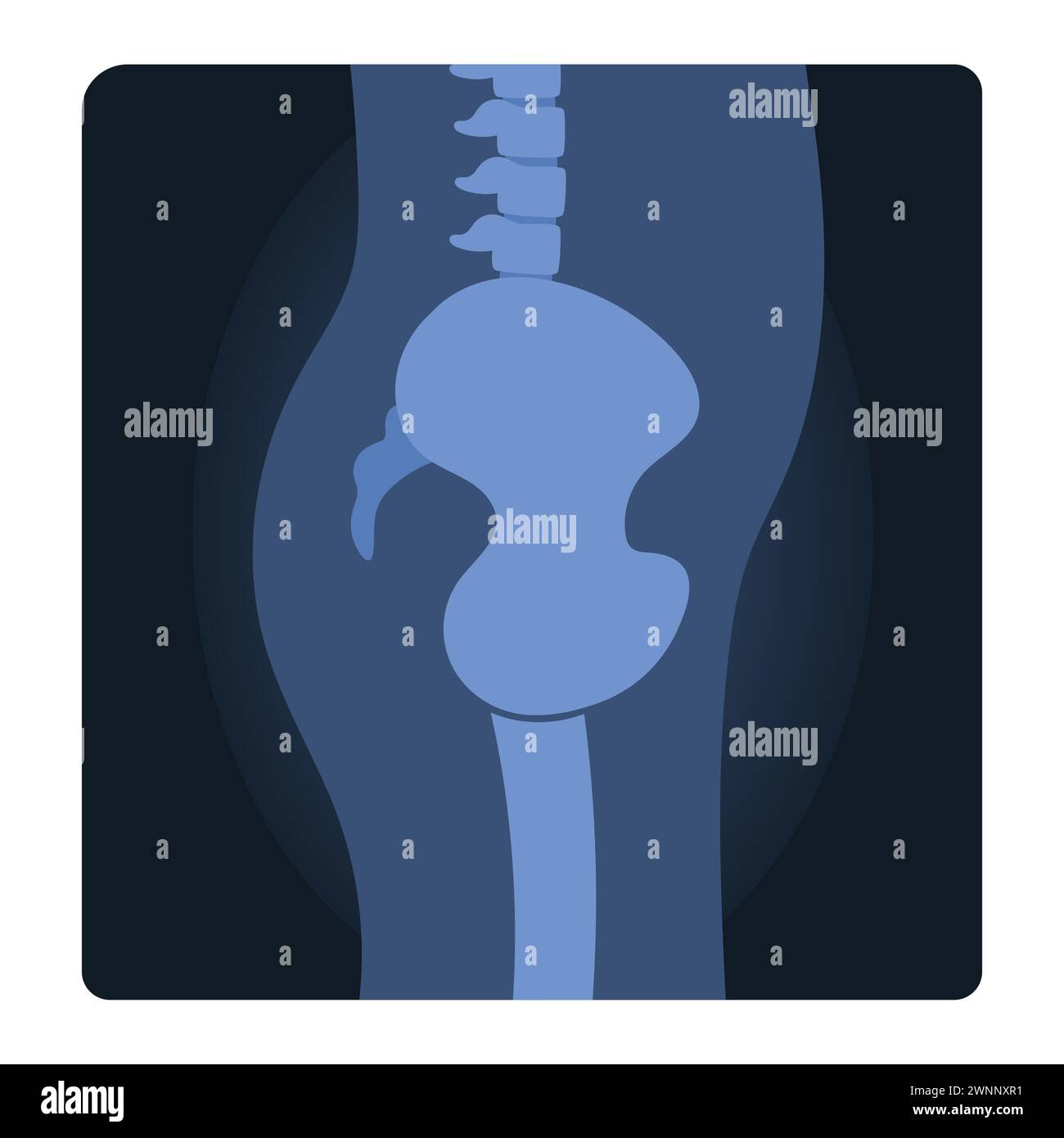 Xray shot of human body. Medical skeleton test, body radiography ...