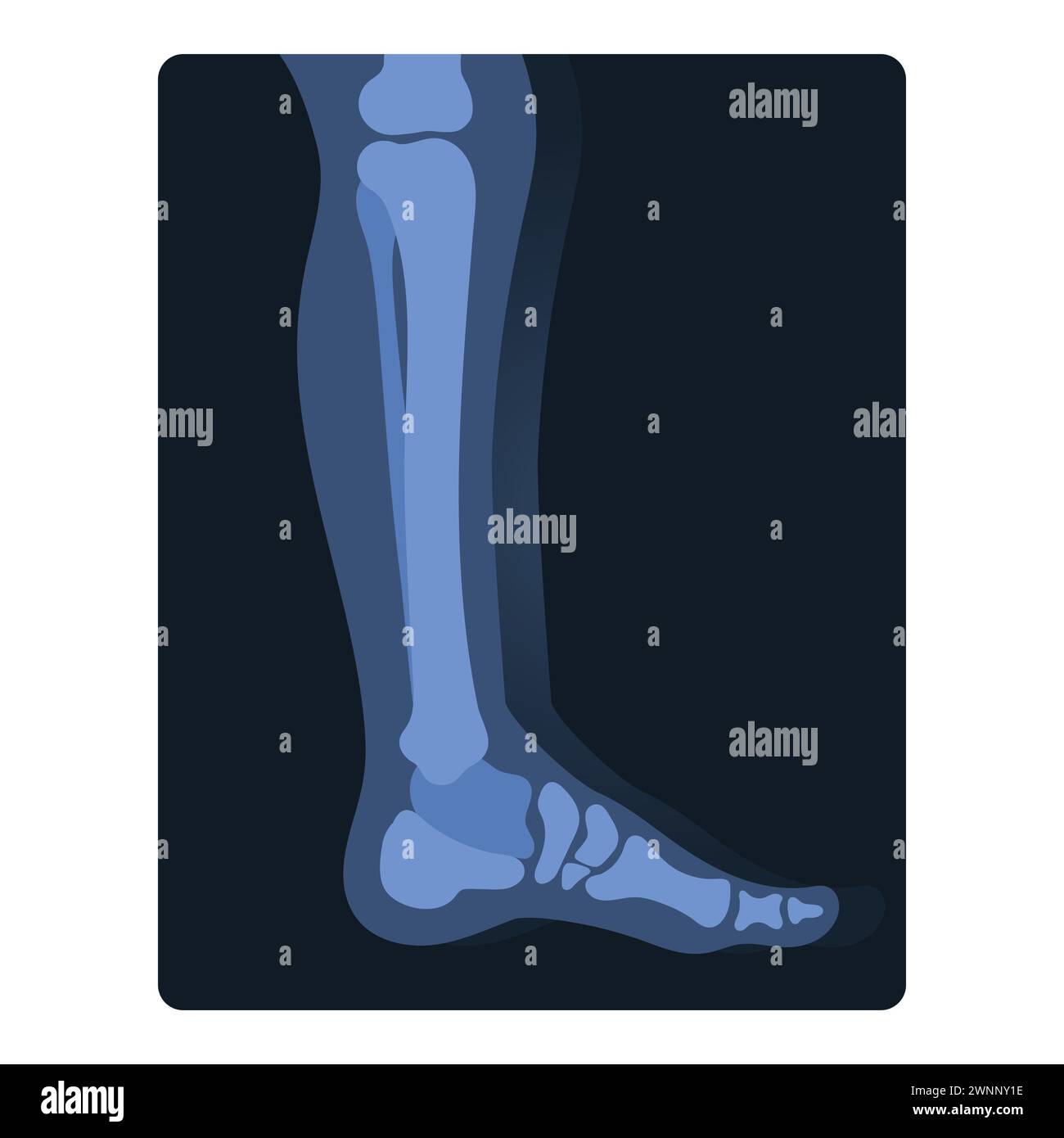 Xray shot of human leg. Medical skeleton test, body radiography cartoon ...