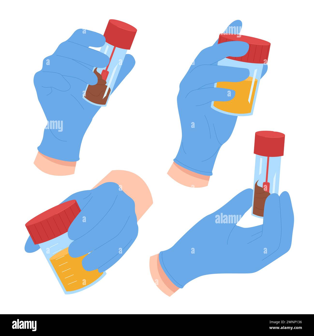 Laboratory analysis of urine and feces for medical clinical diagnosis ...