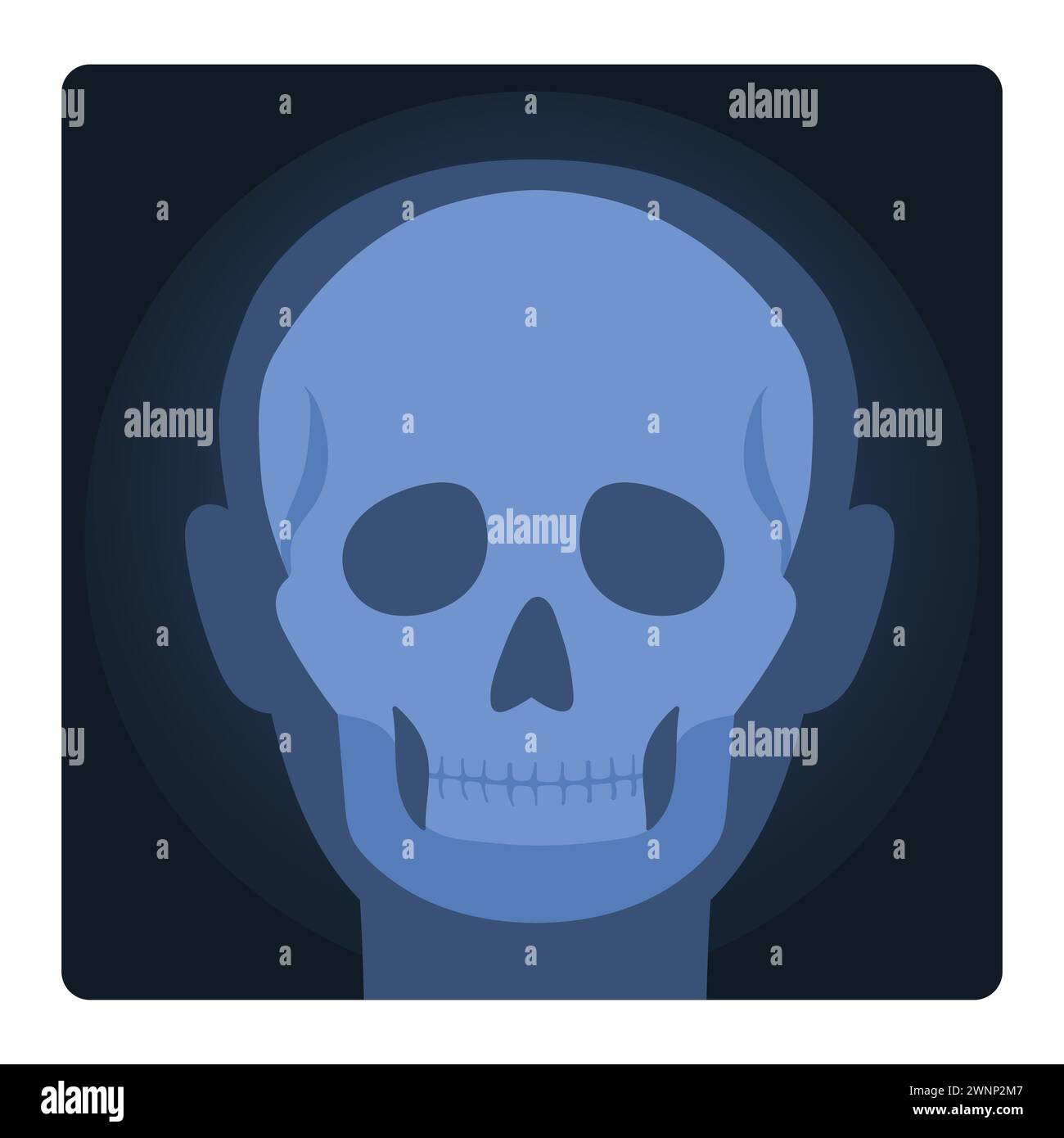 Xray shot of human head. Medical skull test, body skeleton radiography ...