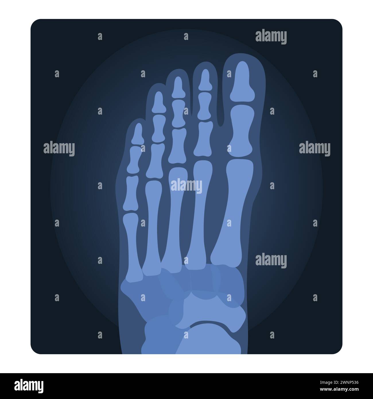 Xray shot of human foot. Medical skeleton test, body radiography ...