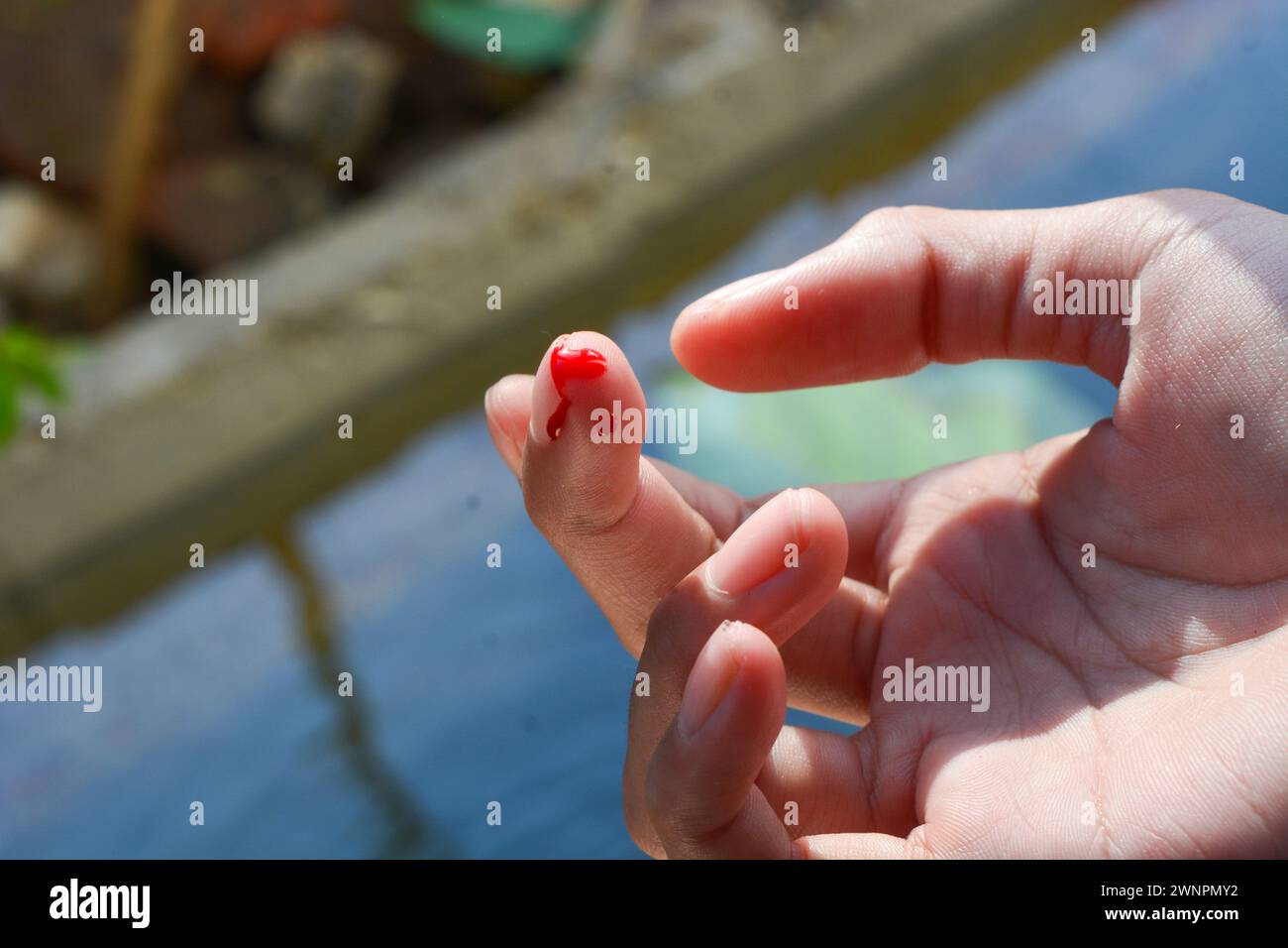 Photo of a finger cut, cut by a knife, bleeding fresh red blood Stock ...