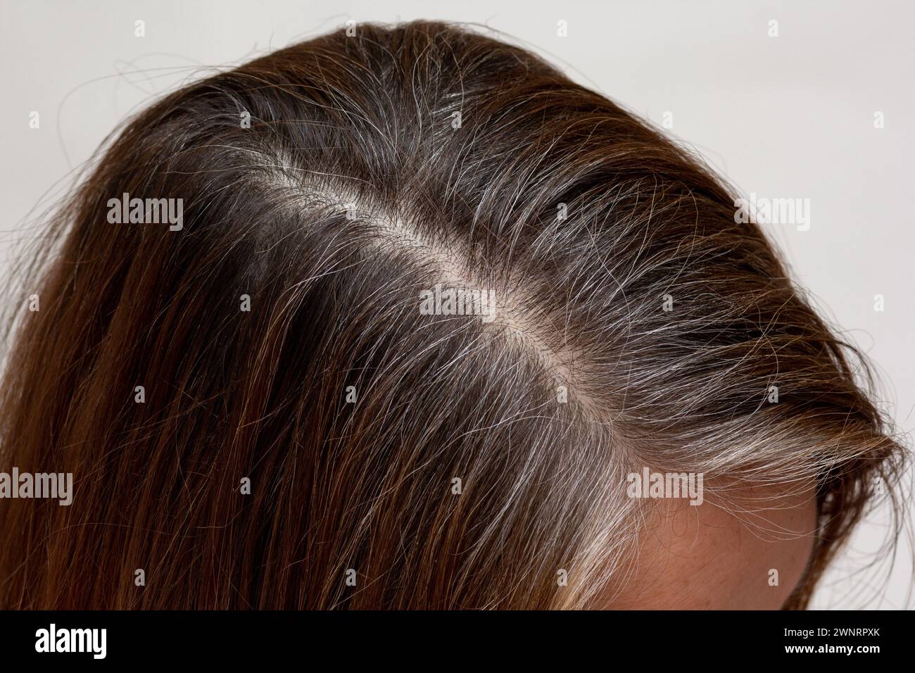 Regrowth process hi-res stock photography and images - Alamy