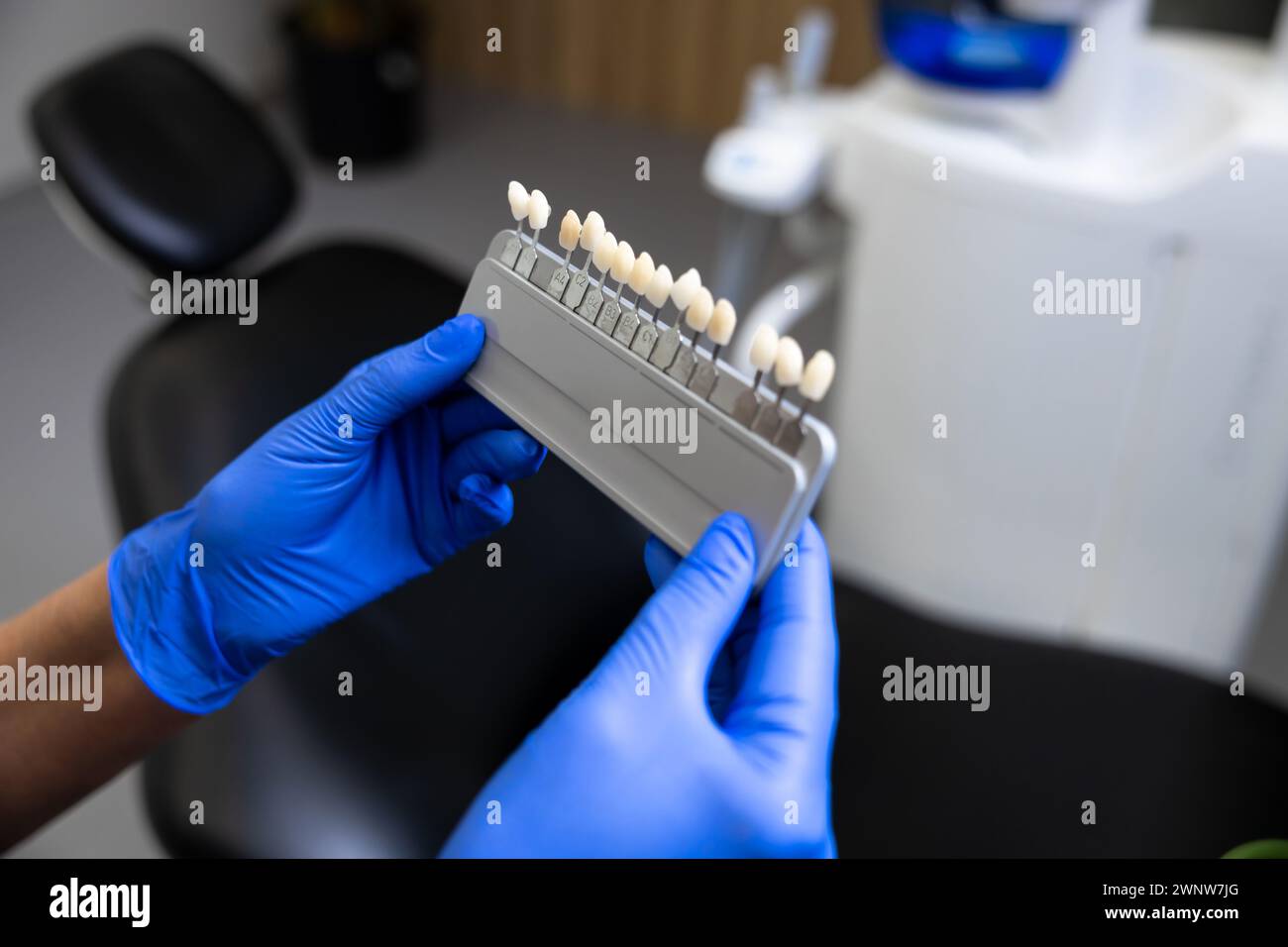 Dentist's hands holding tooth color chart vita scale teeth bleaching ...