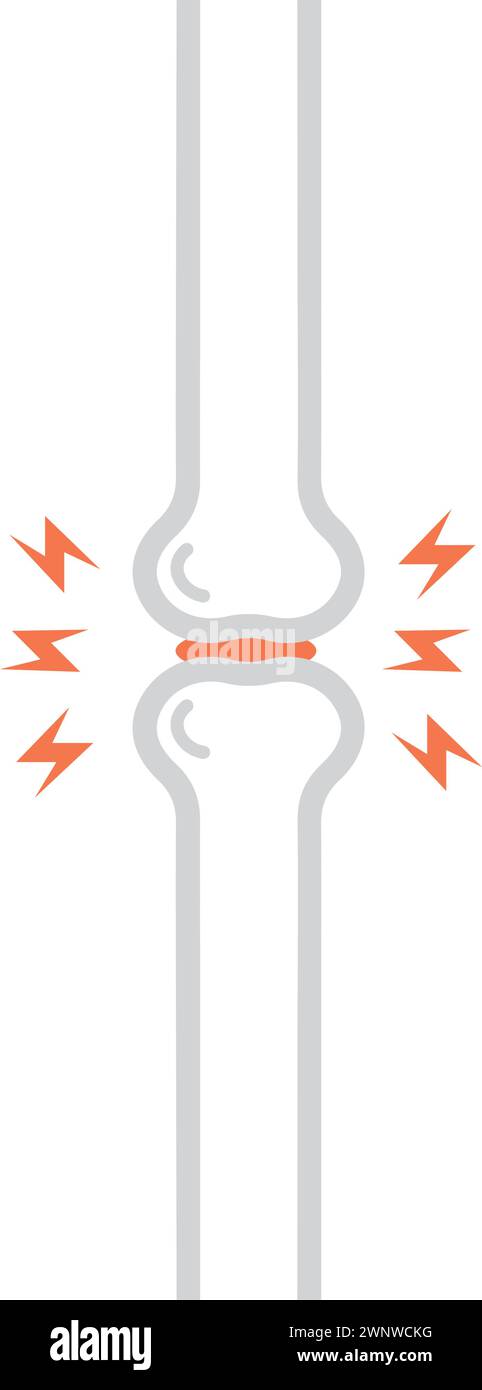 Arthritis knee joint pain. Pixel perfect, editable stroke icon Stock ...