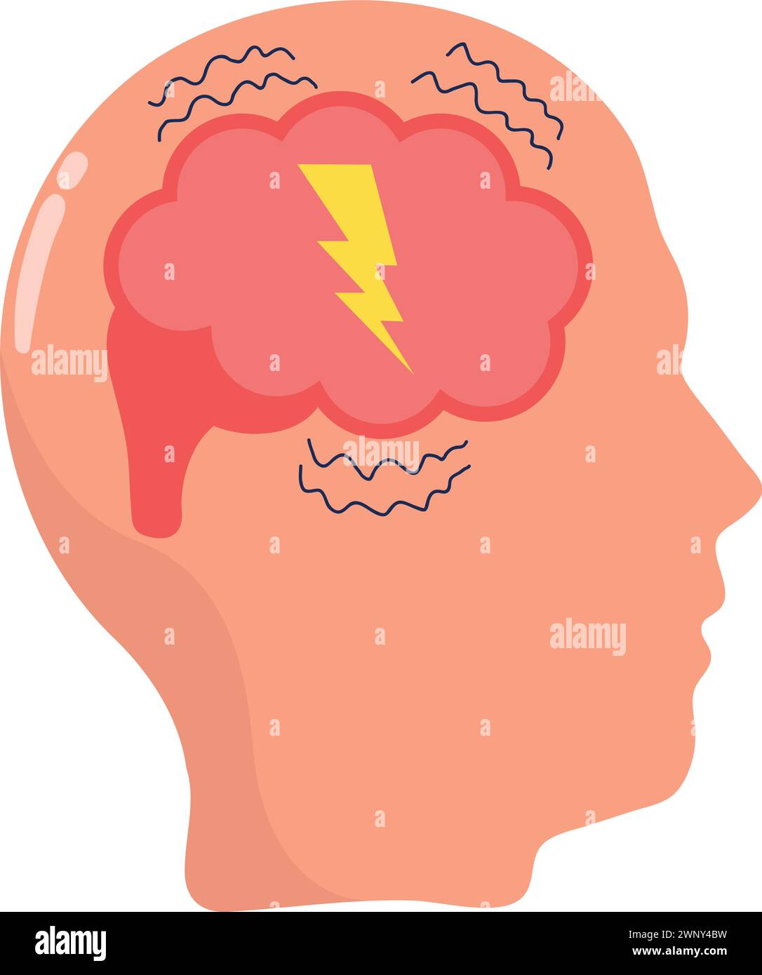 parkinson brain condition Stock Vector Image & Art - Alamy