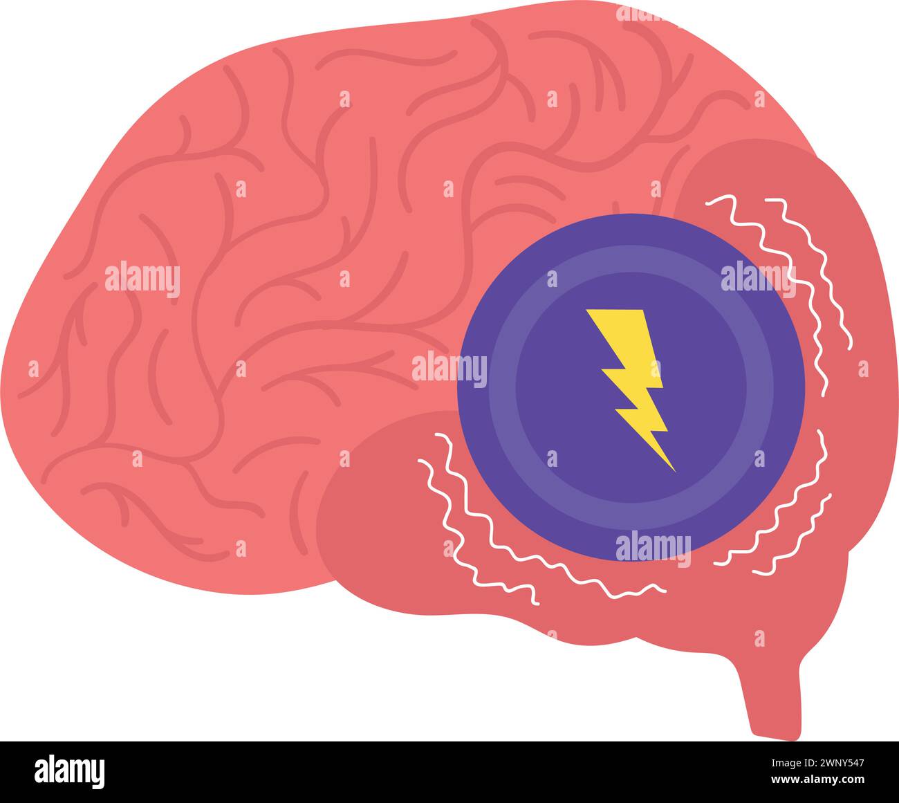 parkinson brain disease Stock Vector Image & Art - Alamy
