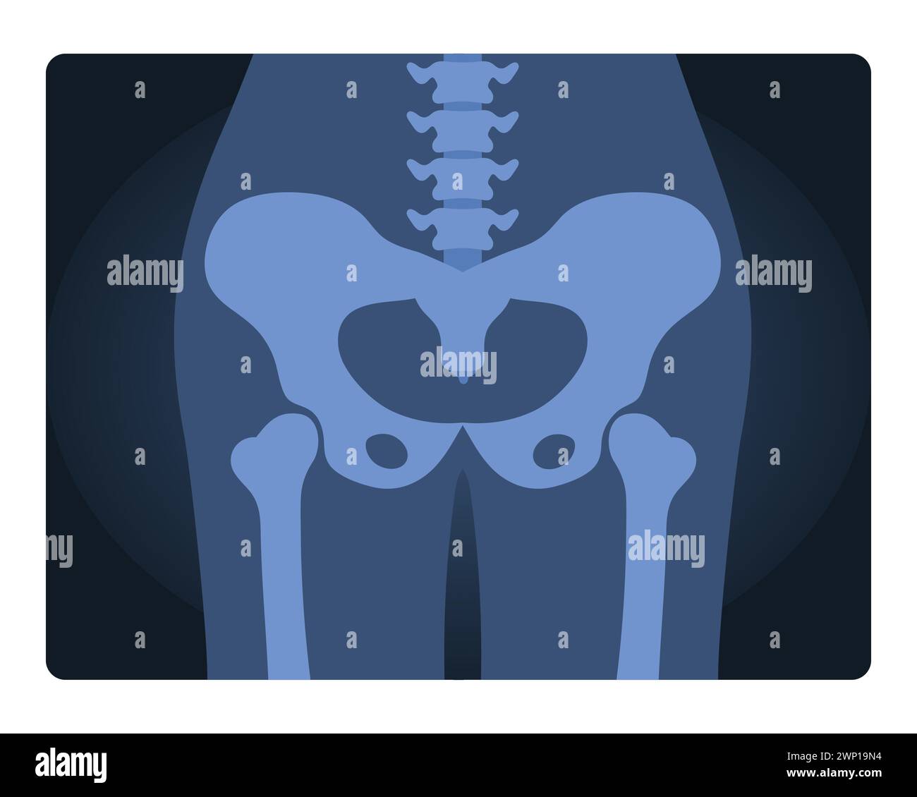 Xray shot of human pelvis. Medical skeleton test, body radiography ...
