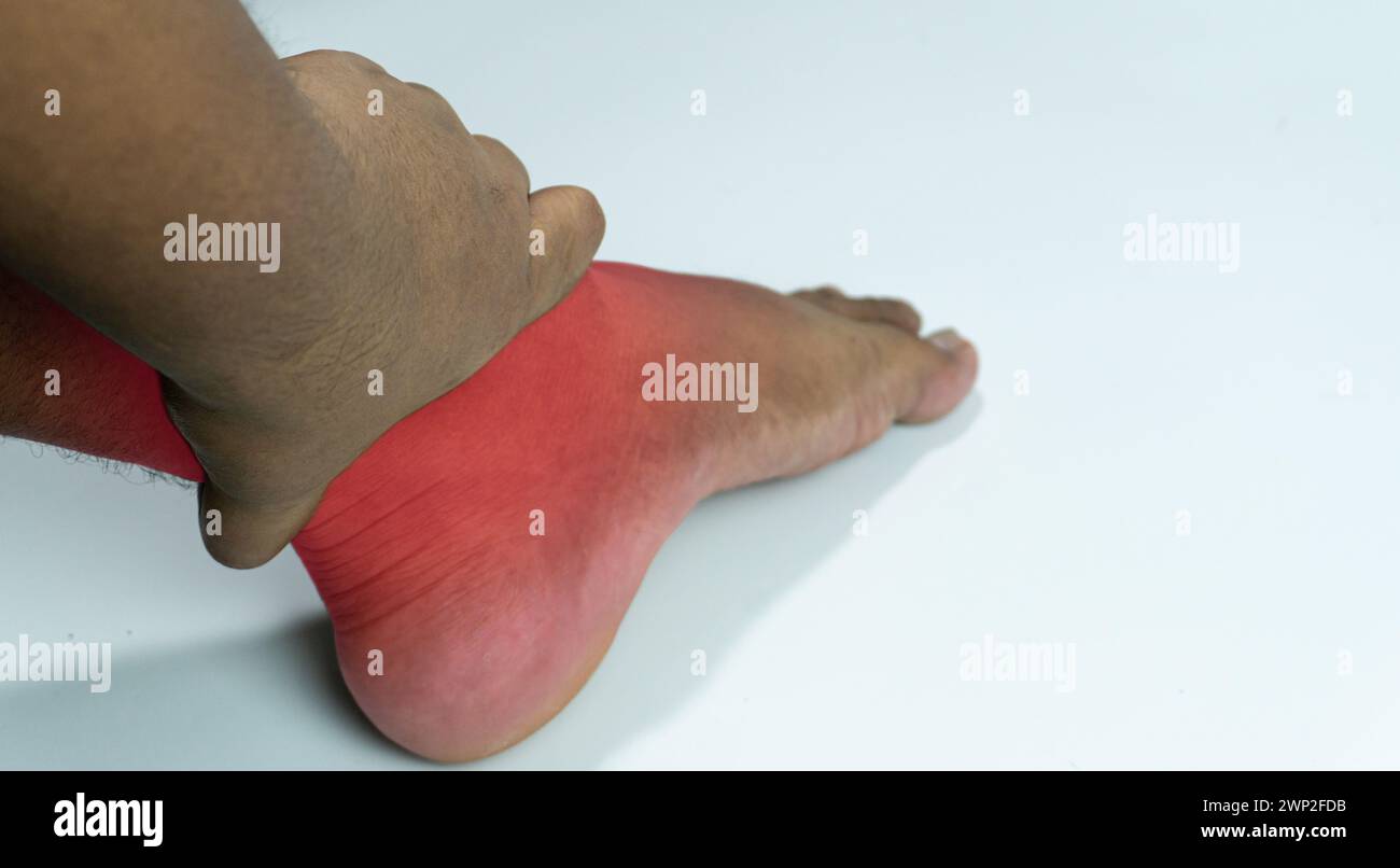 The leg that is injured has the ankle being held with the hand. There ...