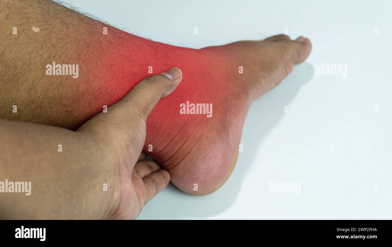 The leg that is injured has the ankle being held with the hand. There ...