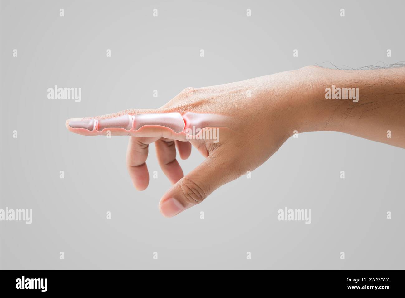 Synovial joint hi-res stock photography and images - Alamy