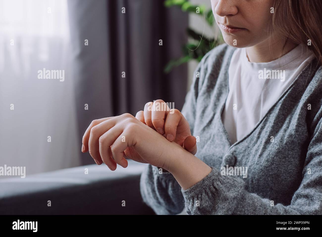 Close up of annoyed sad young caucasian woman itching on her arm have ...