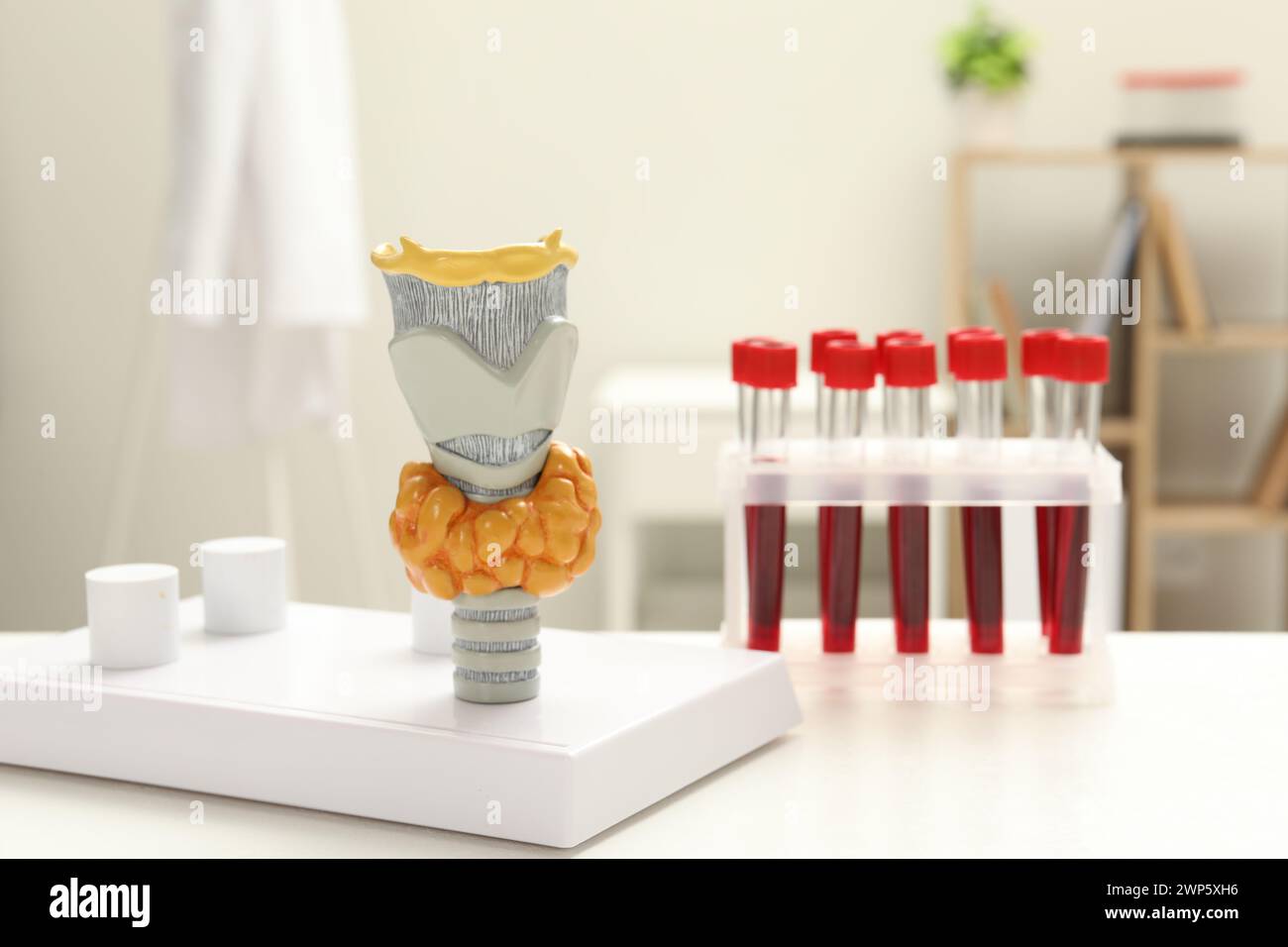 Endocrinology. Model of thyroid gland and samples of blood in test ...
