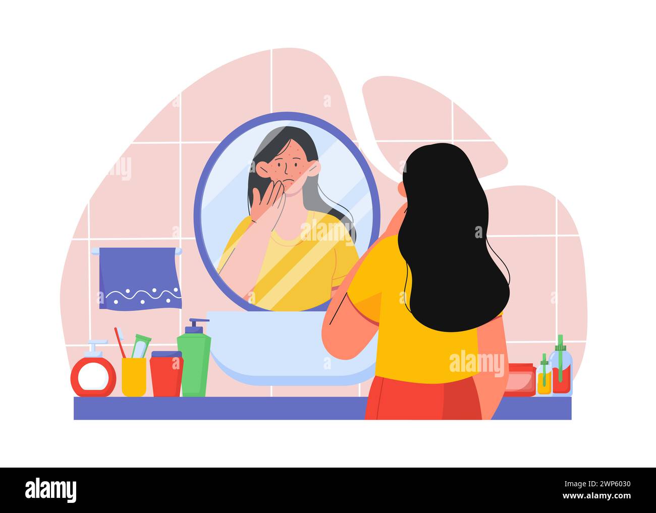 Woman with acne vector Stock Vector Image & Art - Alamy