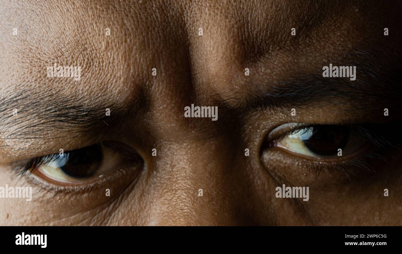 Close up of eyes looking forward, with a slightly wrinkled facial ...