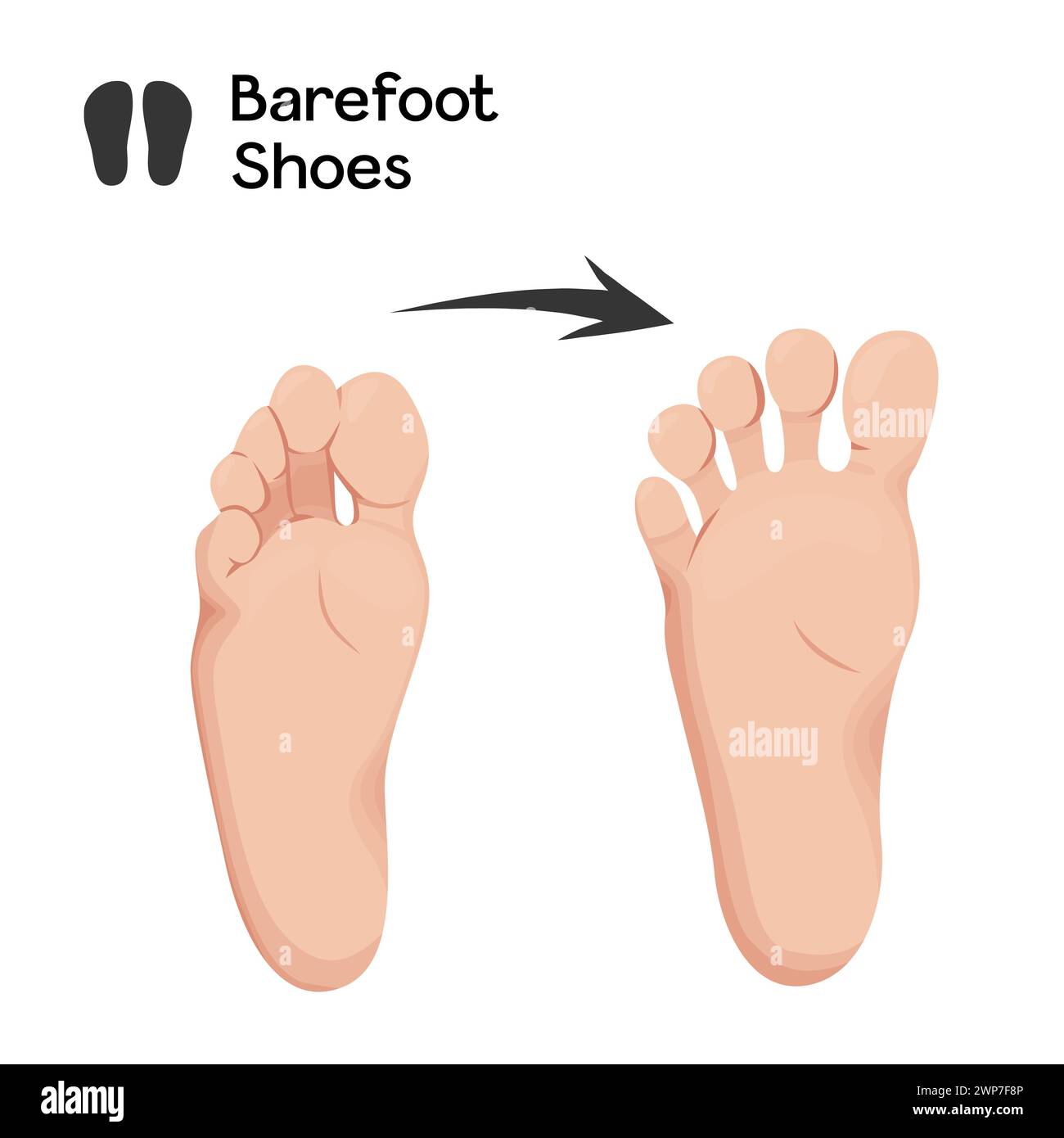 Barefoot shoes care vector illustration. Orthopedic and anatomical ...