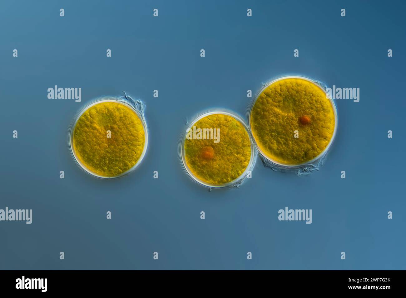 Algae, light micrograph Stock Photo - Alamy