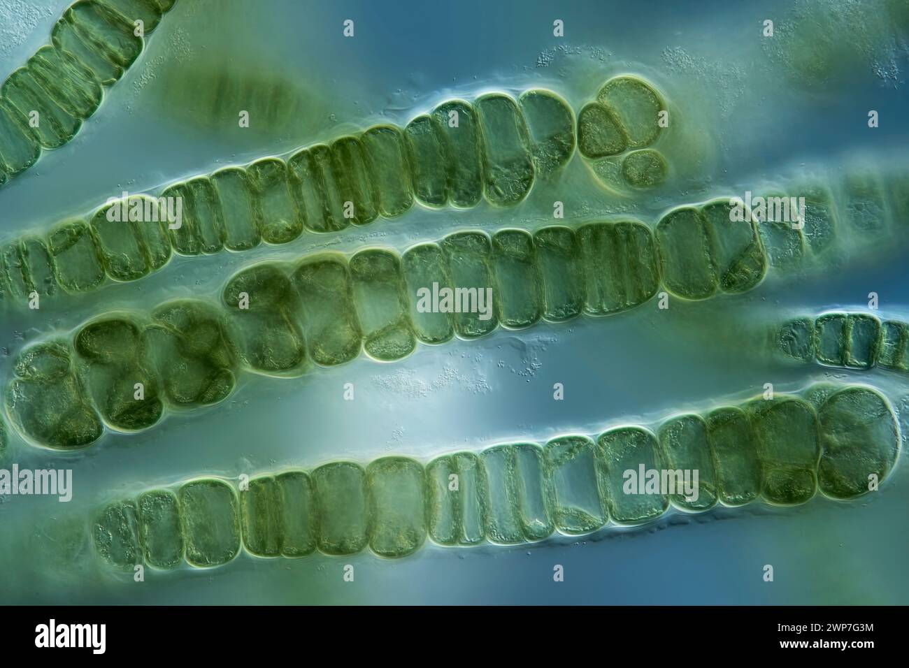 Algae, light micrograph Stock Photo - Alamy