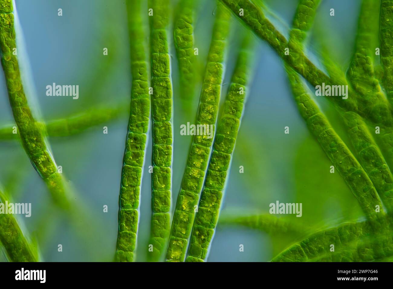 Algae, light micrograph Stock Photo - Alamy