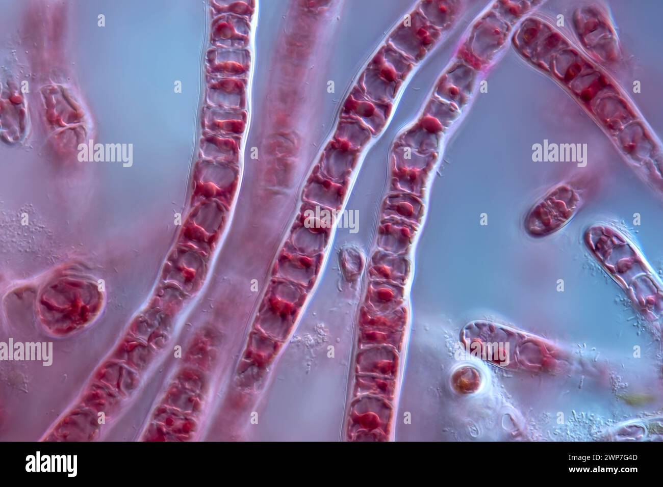 Red algae, light micrograph Stock Photo - Alamy