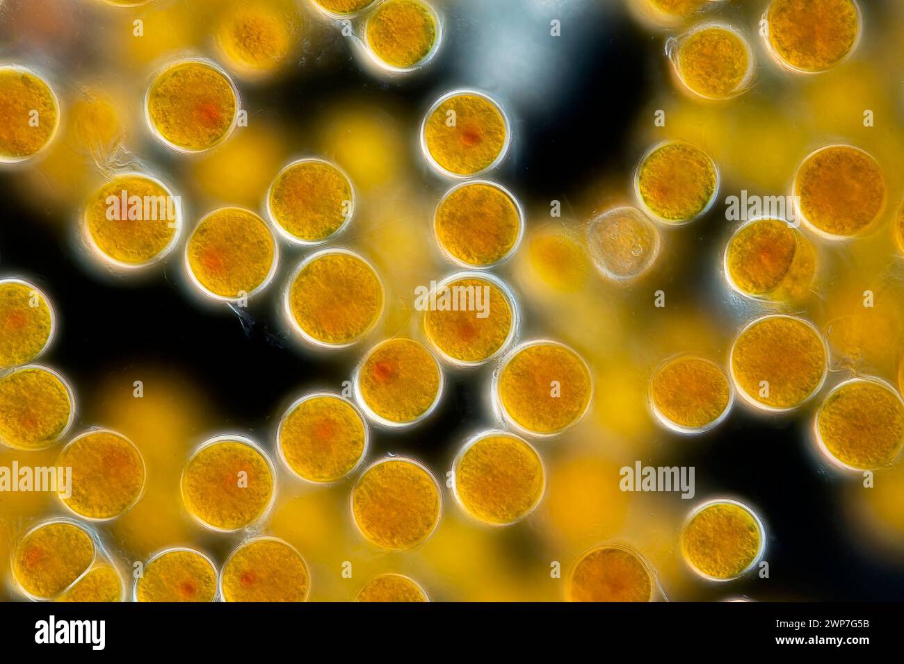 Algae, light micrograph Stock Photo - Alamy