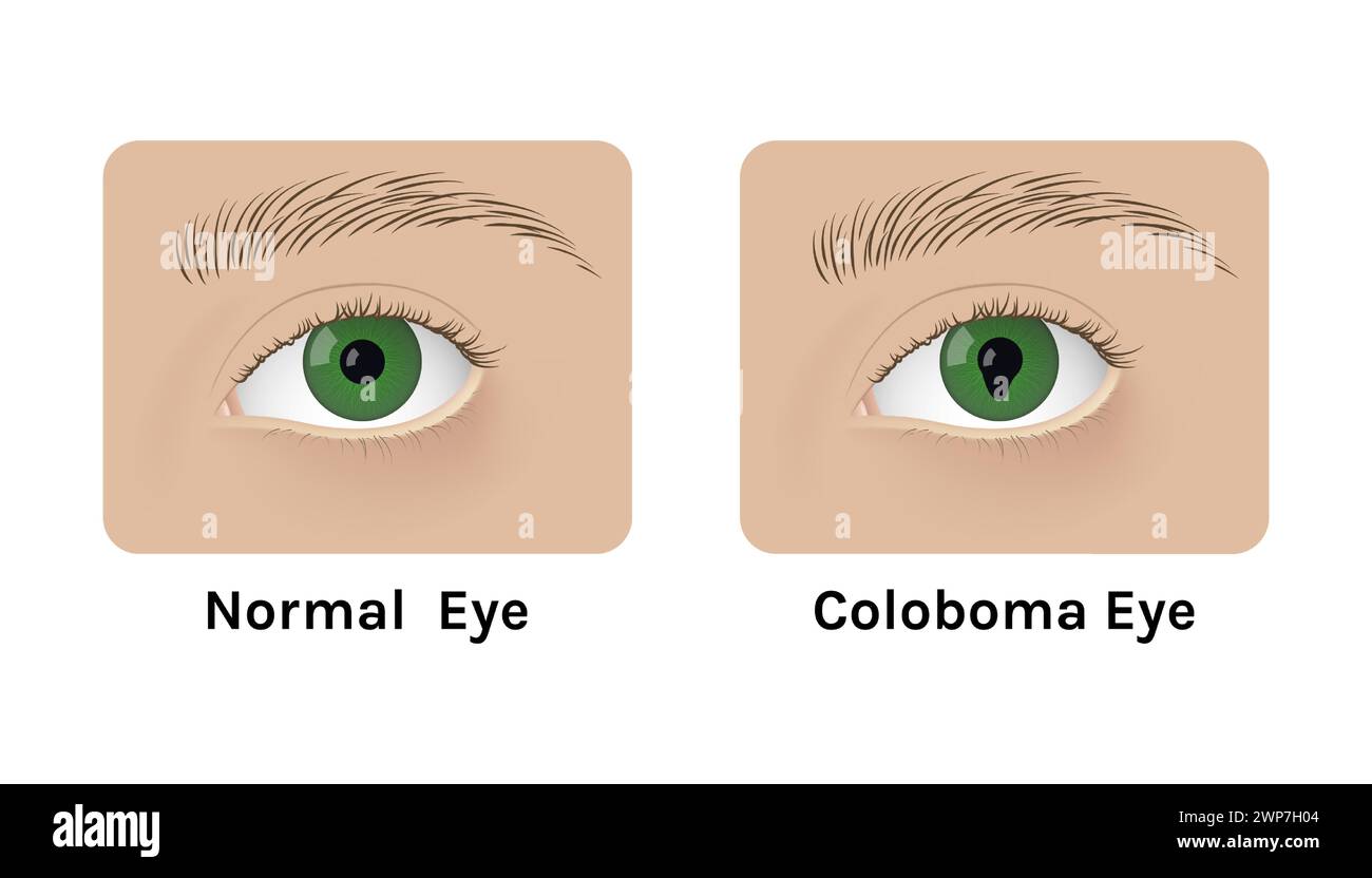 Realistic human normal eyes and with colomba vector illustration design ...