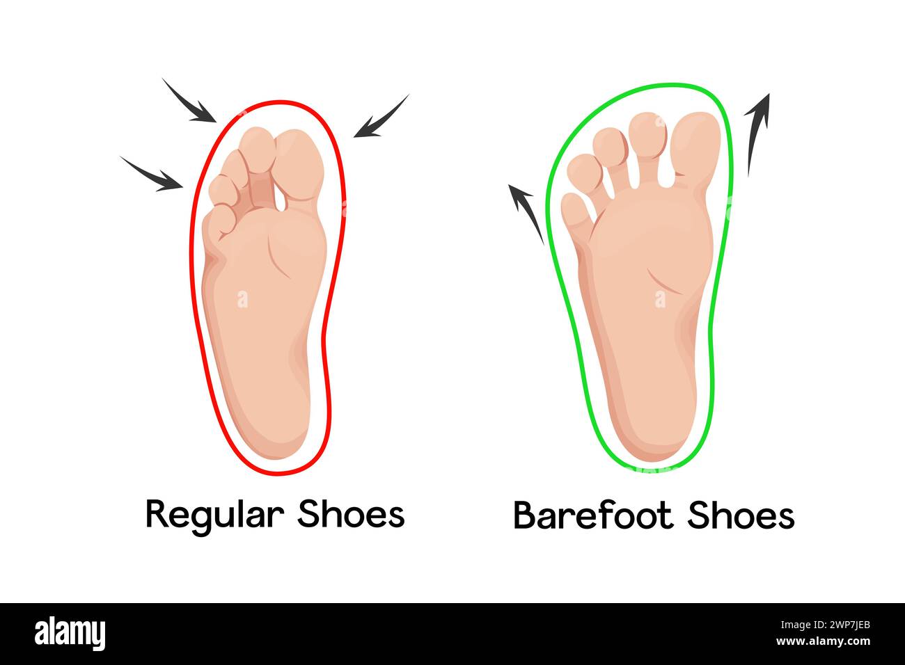 Barefoot shoes care vector illustration infographic. Orthopedic and ...