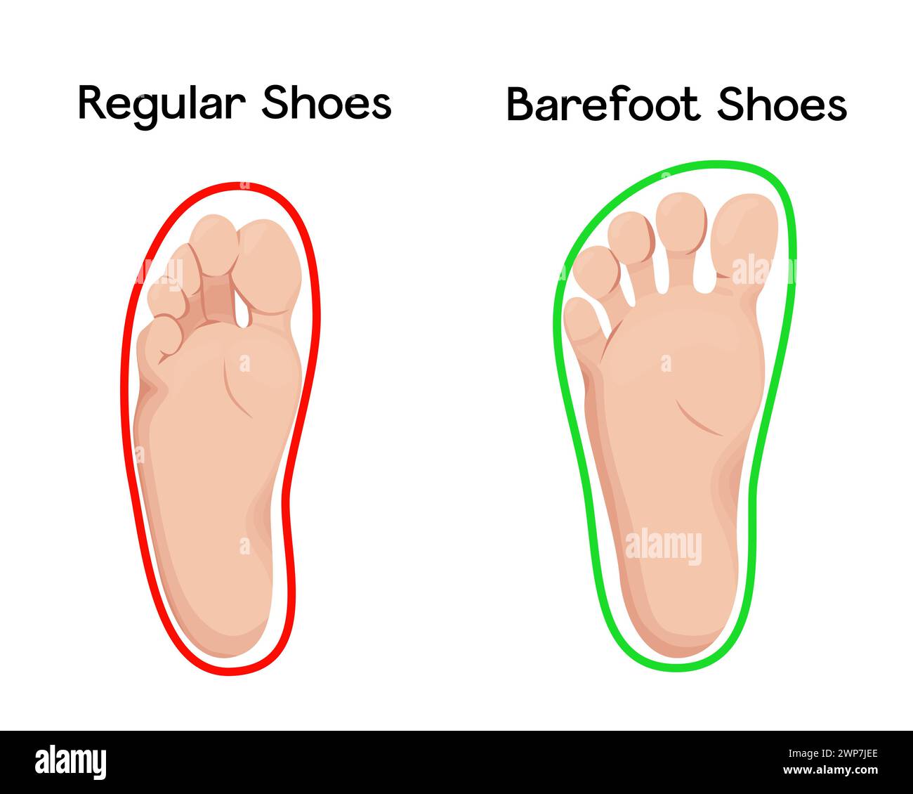Barefoot shoes impacts on feet vector illustration infographic. Compare ...