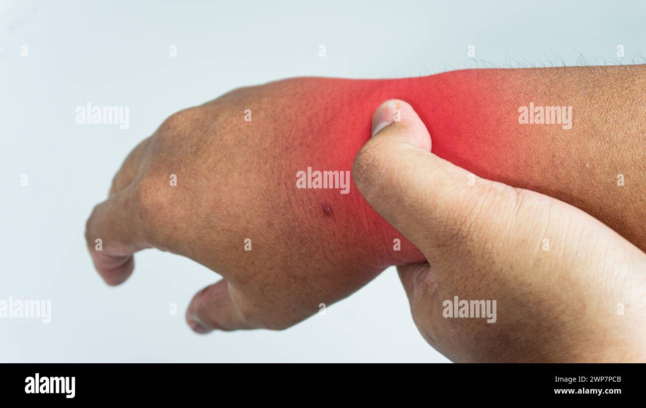 The sore hand that is being held. The sore wrist has a red mark in the ...