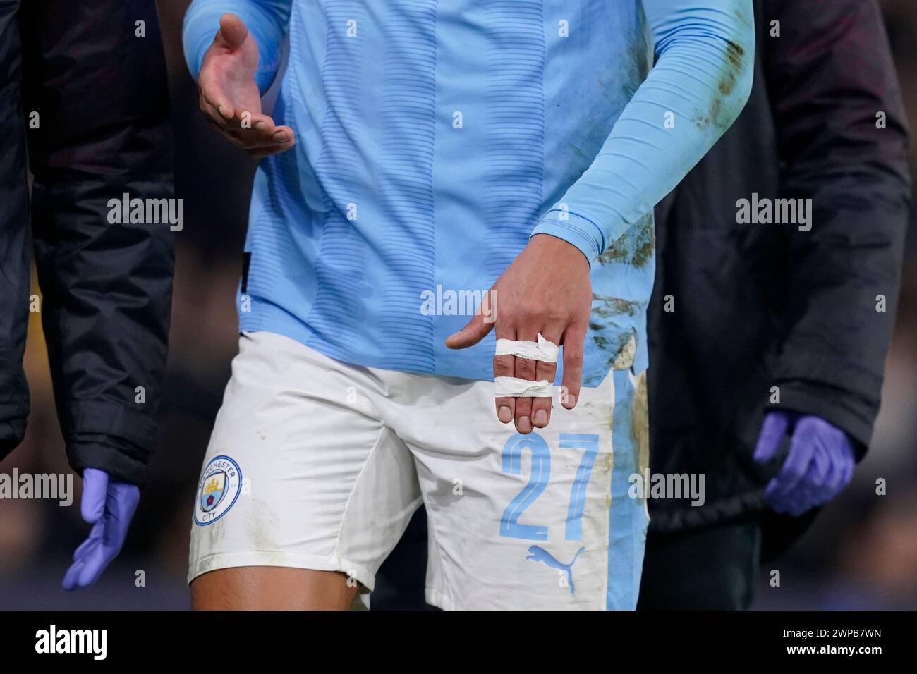 Dislocated sport hi-res stock photography and images - Alamy