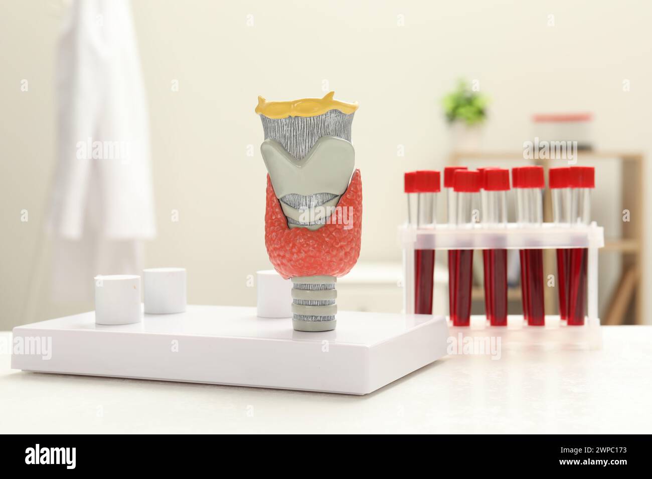 Endocrinology. Model of thyroid gland and samples of blood in test ...
