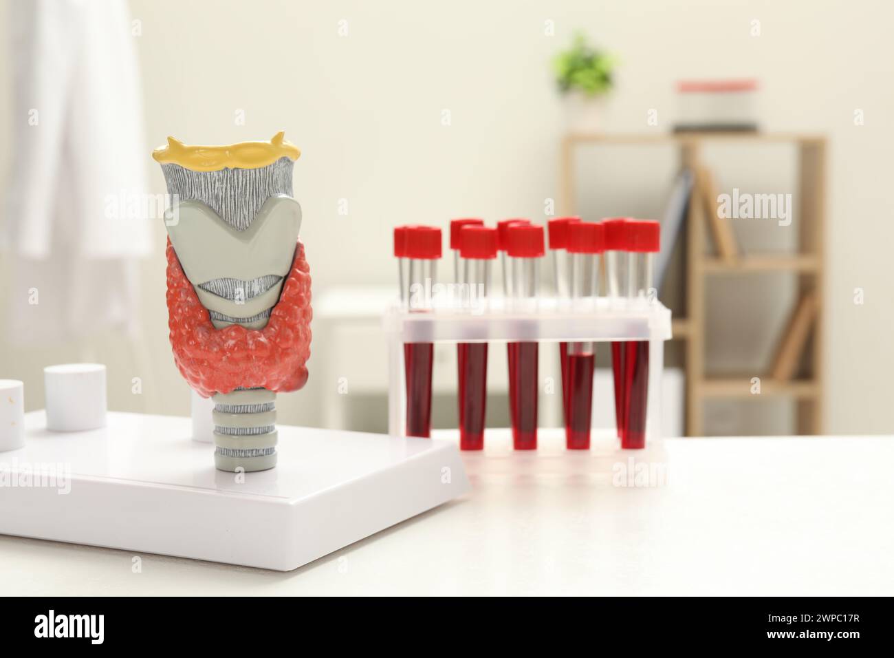 Endocrinology. Model of thyroid gland and samples of blood in test ...