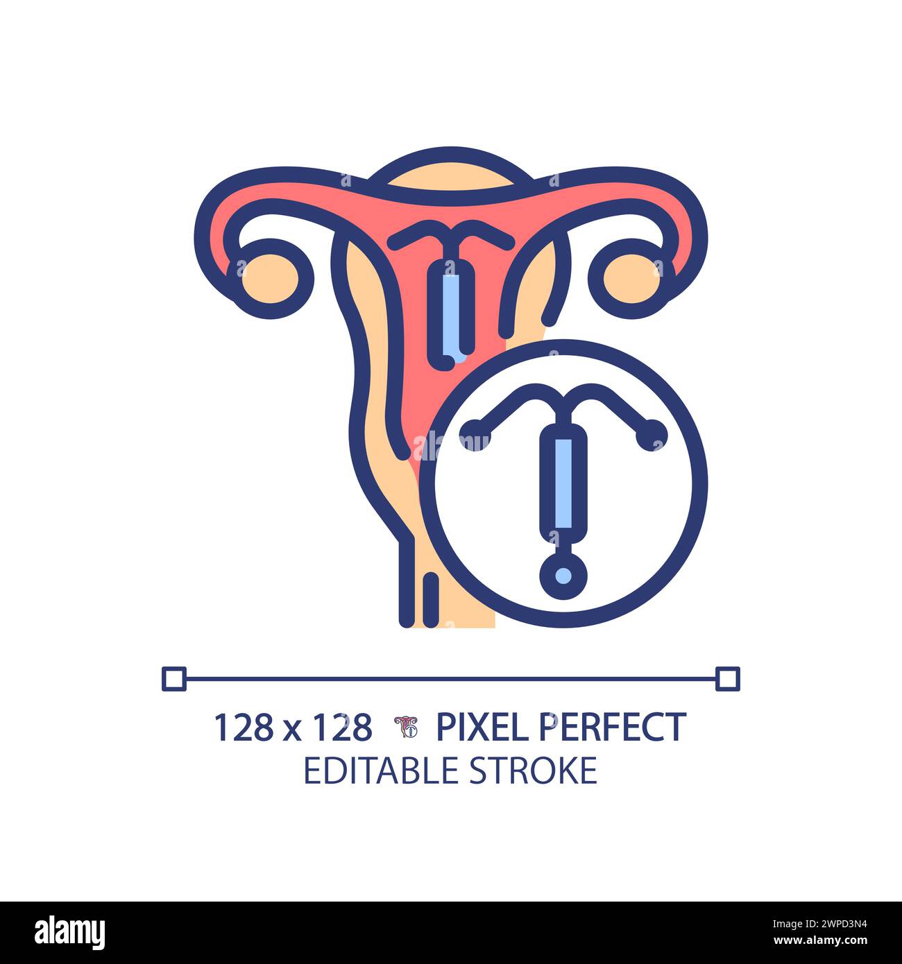 Intrauterine device hi-res stock photography and images - Alamy