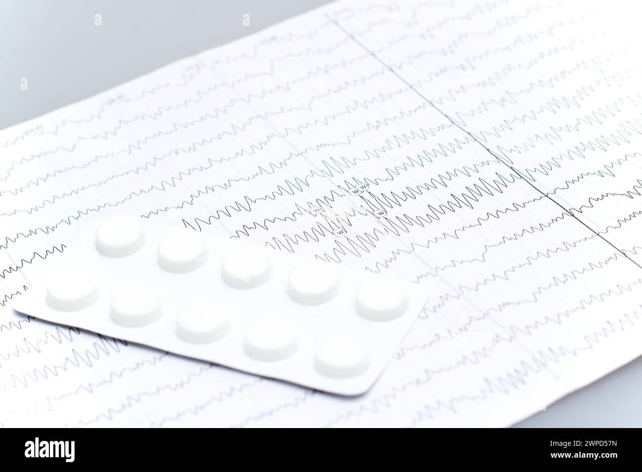 Eeg chart graph hi-res stock photography and images - Alamy