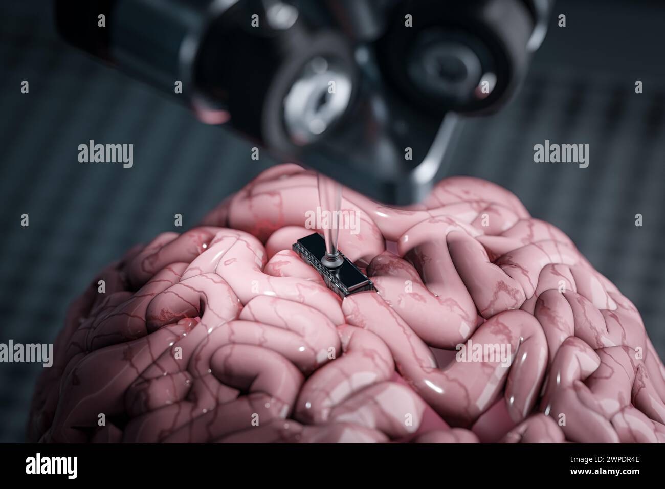 The concept of implanting a chip into the human brain with the help of ...