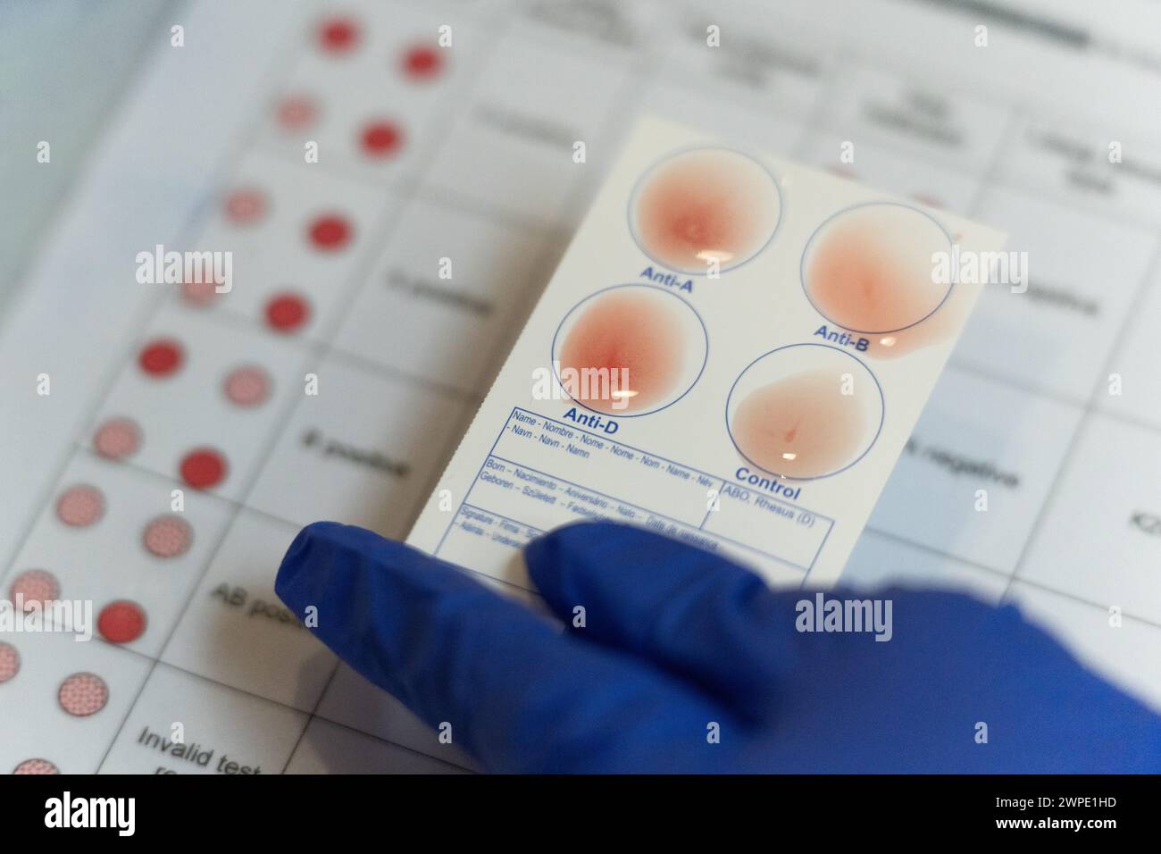 Blood group test hi-res stock photography and images - Alamy