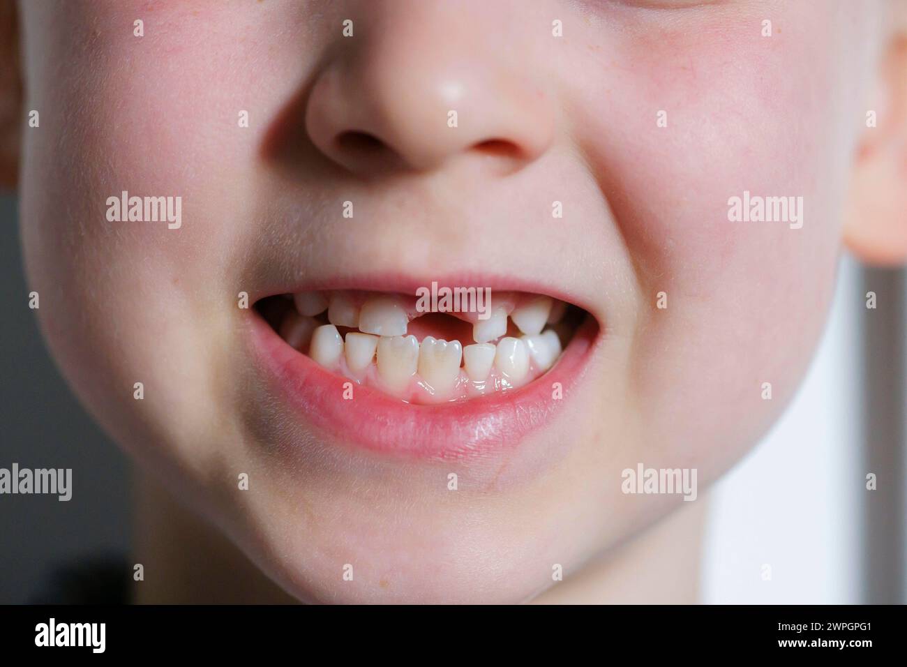 Berlin, Deutschland. 07th Mar, 2024. Symbolic photo on the subject of ...