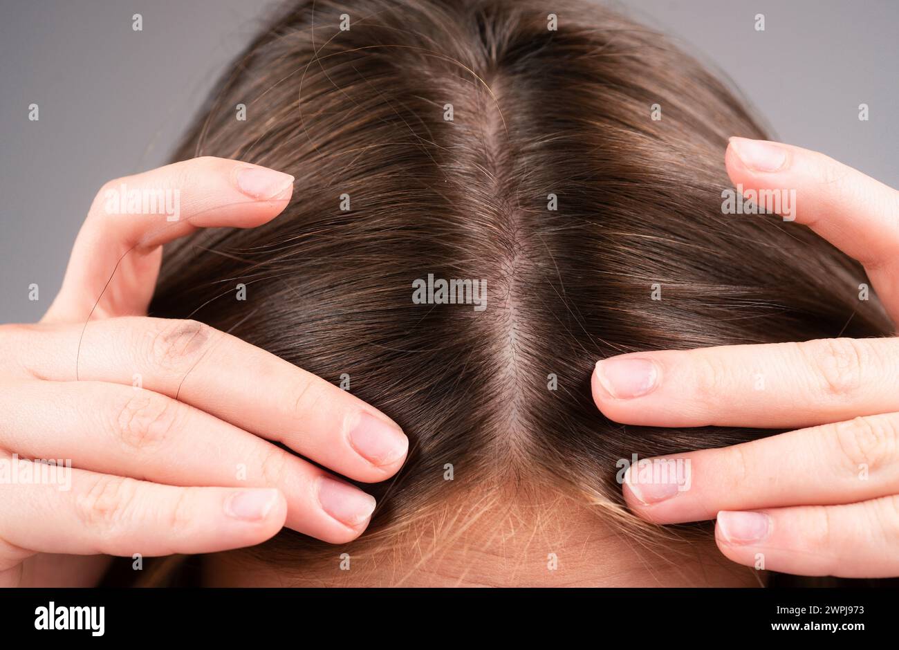 Woman worried about hair loss. Hair fall problem Stock Photo - Alamy