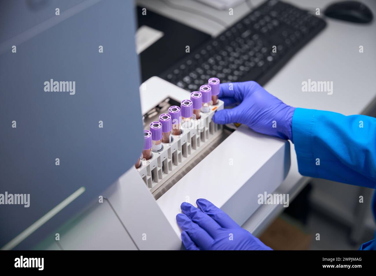 Laboratory technician does a general blood test Stock Photo - Alamy