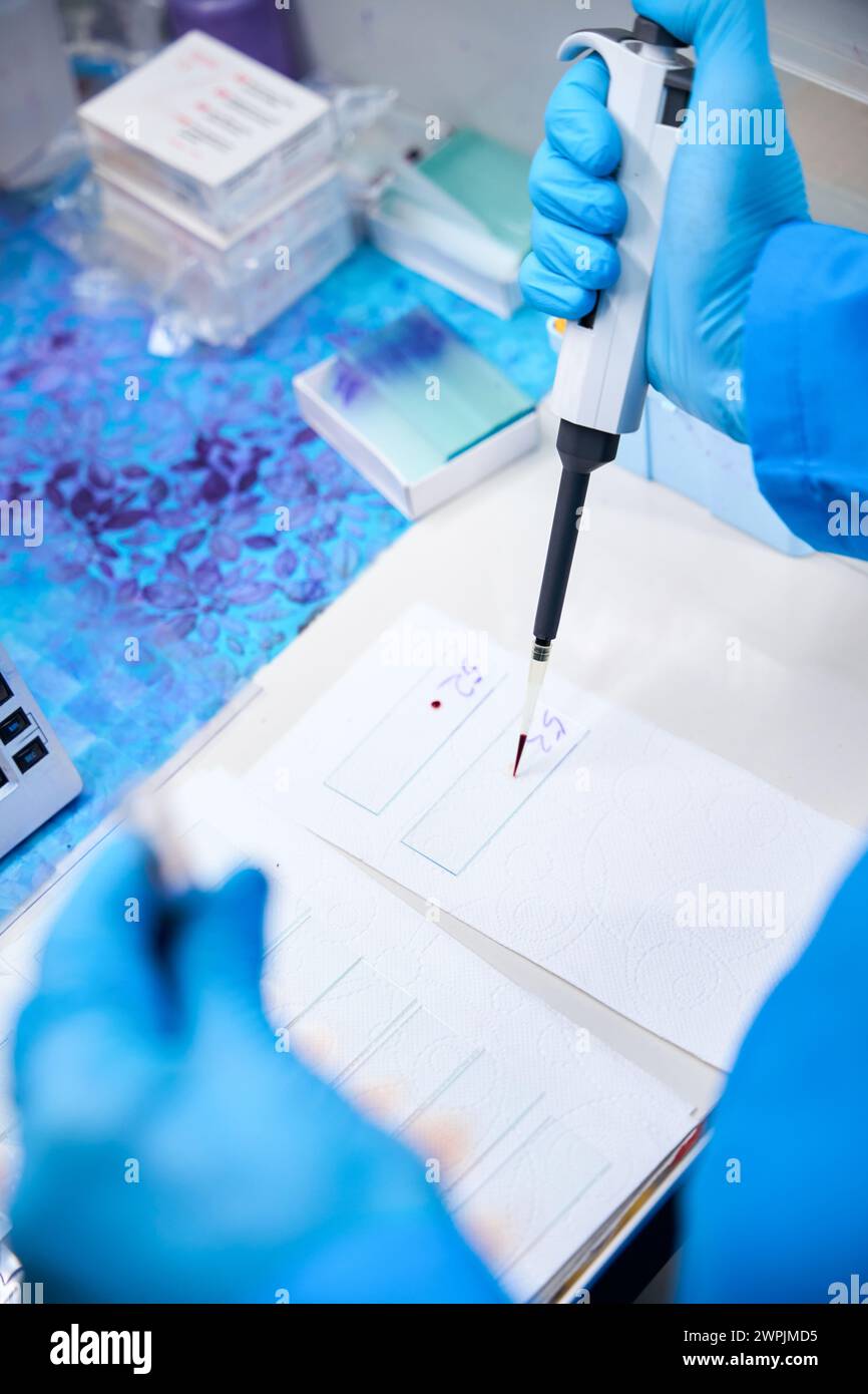 Laboratory worker makes a general blood test Stock Photo - Alamy
