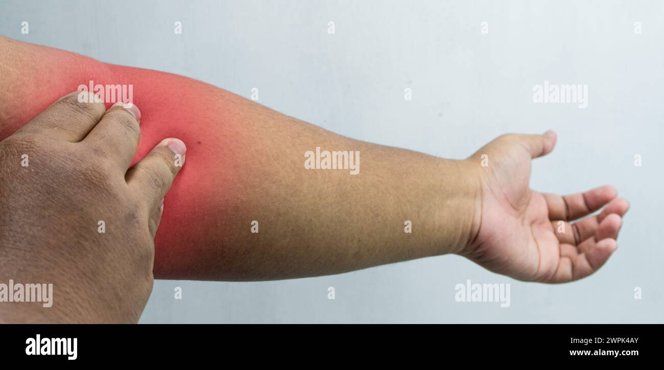 Parts of the hand joints that are sick or injured. The painful area is ...