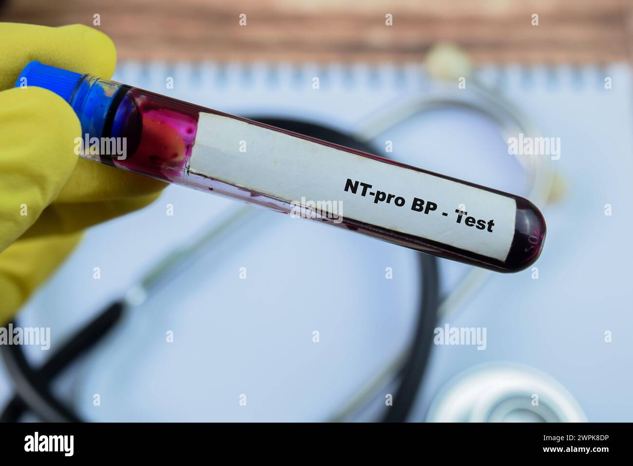 NT-pro BP - Test with blood sample on wooden background. Healthcare or ...